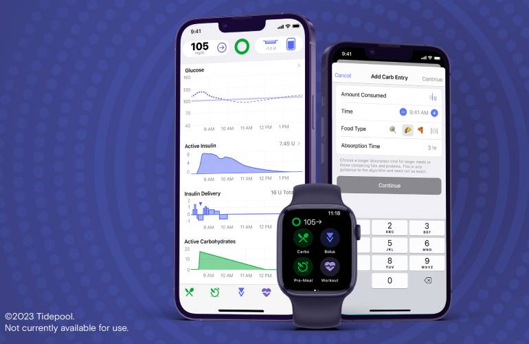 Tidepool Loop automated insulin delivery system wins FDA clearance - Medical Design Sourcing